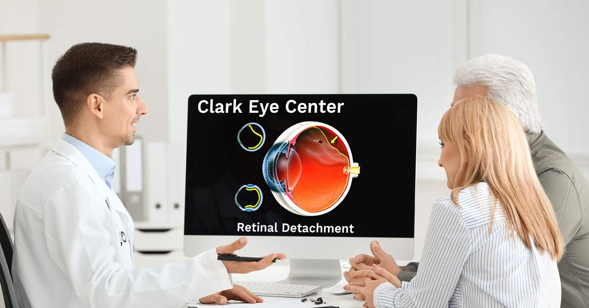 Eye GIFs - Digital Ophthalmic Patient Education